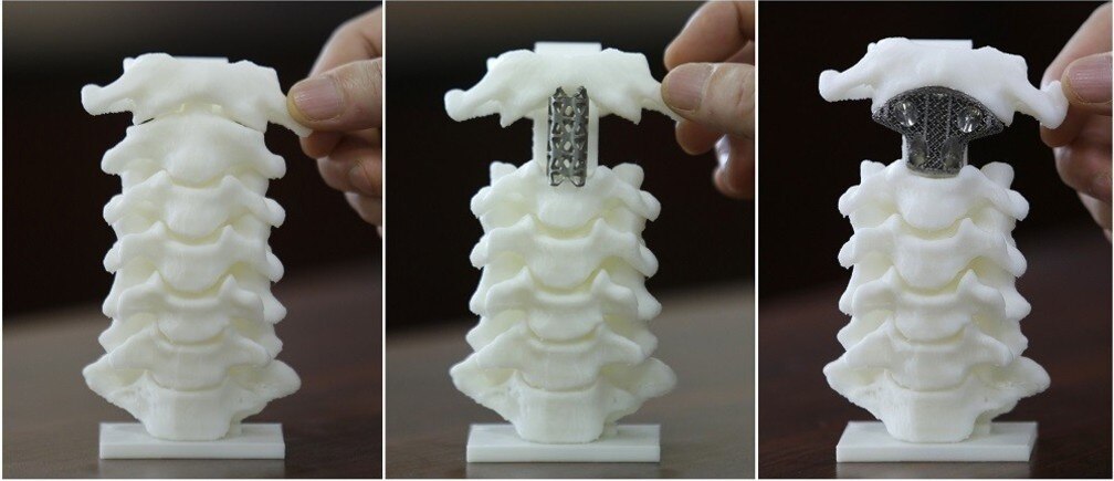 Which Parts Of The Body Can We 3D Print World Economic Forum Which Parts Of The Body Can We 3D Print World Economic Forum