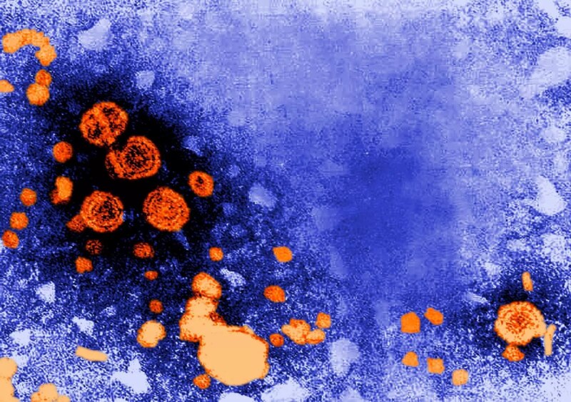Hepatitis explained — what is it, and what are the symptoms? | World ...