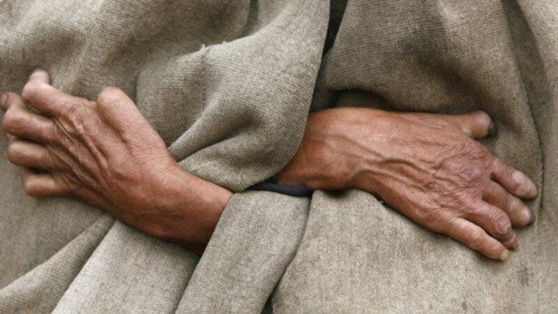 The newly discovered secrets of the protein that makes skin stretchy ...