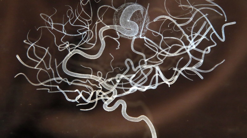 What war has taught us about the human brain | World Economic Forum