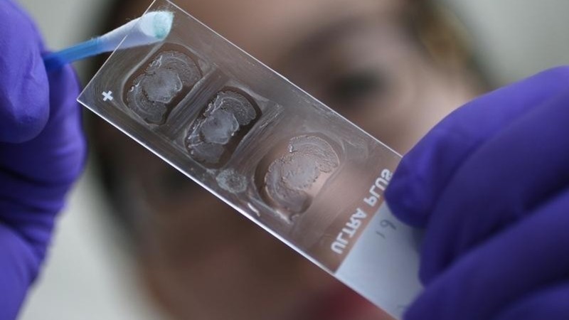 How nanotech is changing your world | World Economic Forum