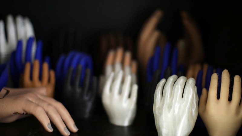 'E-Glove' gives prosthetic hands human touch and warmth | World ...