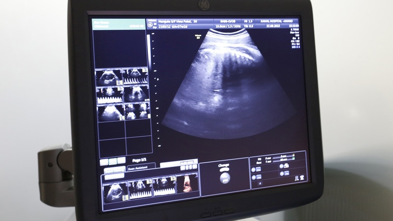 Telling languages apart may begin in the womb | World Economic Forum