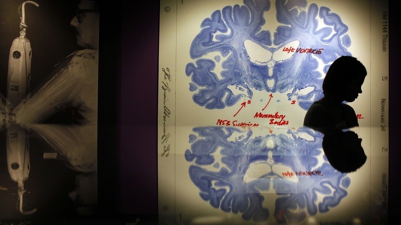 How our ancient brains learn new things | World Economic Forum