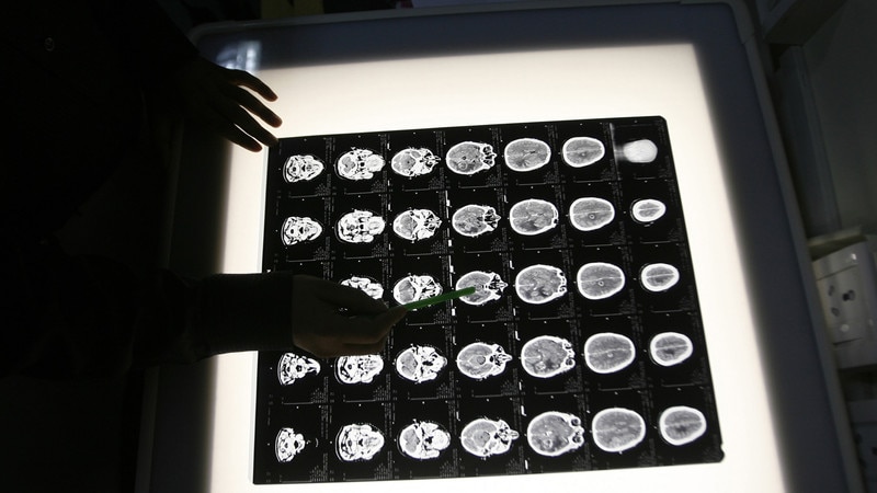 Why is cancer so hard to cure? | World Economic Forum