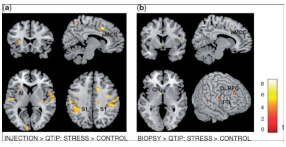 There’s a bright side to stress | World Economic Forum