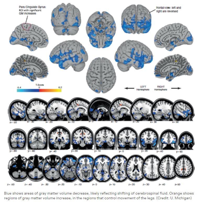 Astronauts’ brains change shape when they go into space | World ...
